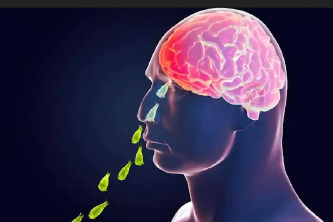 Tourist dies from brain-eating amoeba after returning from Thailand